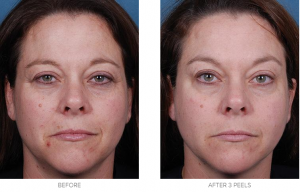 Obagi Clinic in Swansea - Skinfinity Aesthetic Clinic