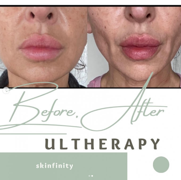 Welcome to Skinfinity Swansea, the award winning aesthetic clinic