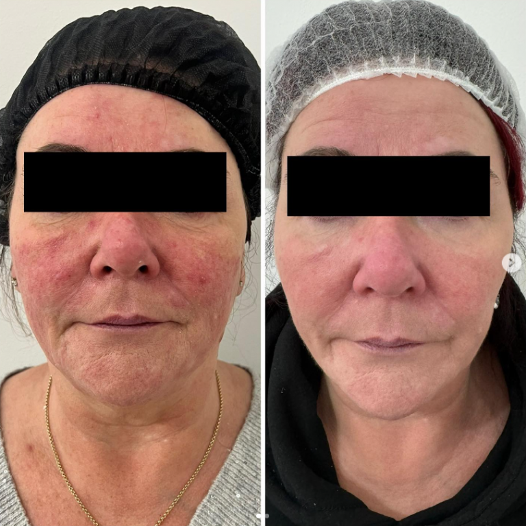 Welcome to Skinfinity Swansea, the award winning aesthetic clinic